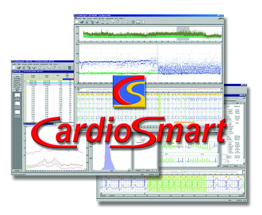 Ultracardio — CardioSmart - Ultracardio